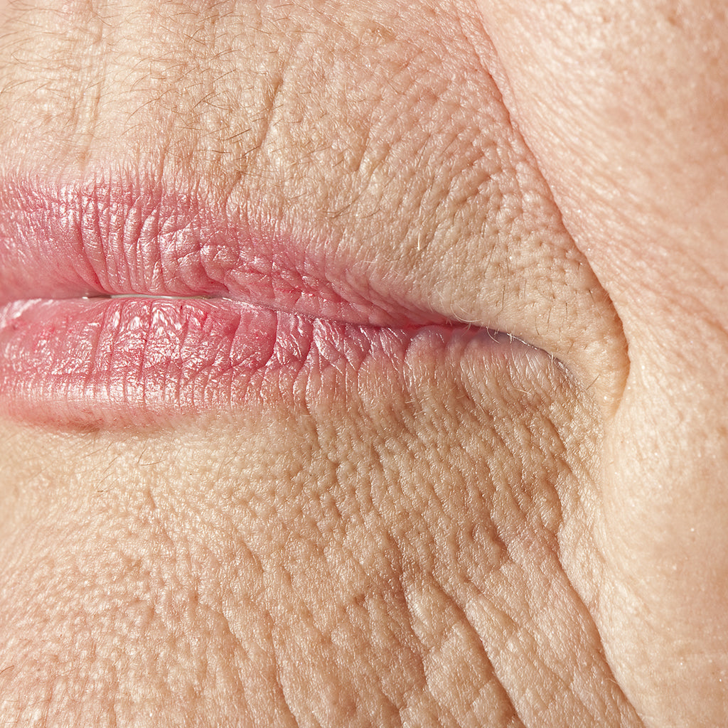 Understanding Glycation: Causes, Prevention, and Treatment – Beauty ...